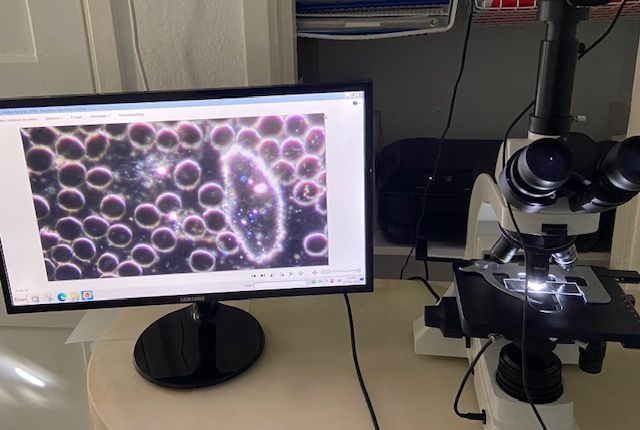 Levend Bloed Analyse - Wat is er te zien in het bloed?